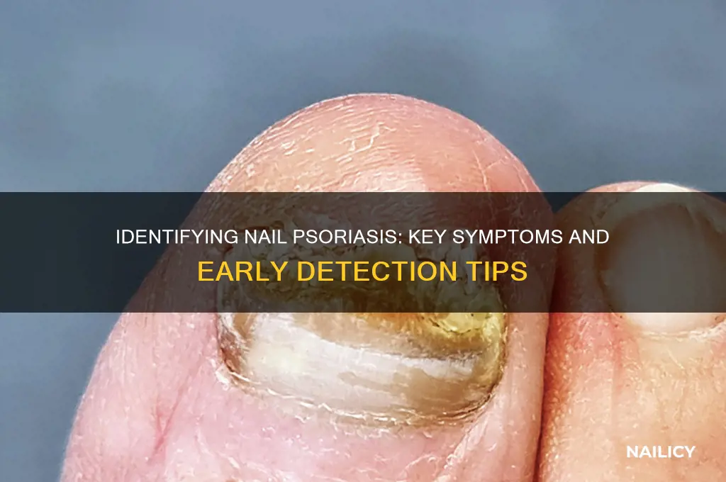 Identifying Nail Psoriasis: Key Symptoms And Early Detection Tips | Nailicy