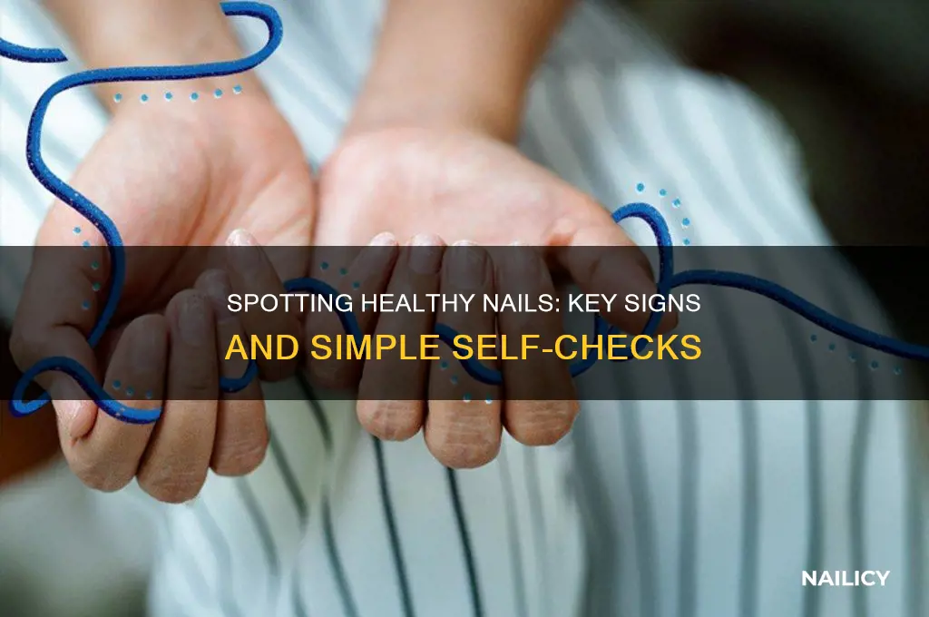 Spotting Healthy Nails: Key Signs And Simple Self-Checks | Nailicy