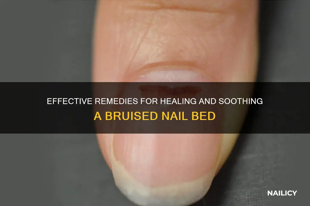 Effective Remedies For Healing And Soothing A Bruised Nail Bed | Nailicy