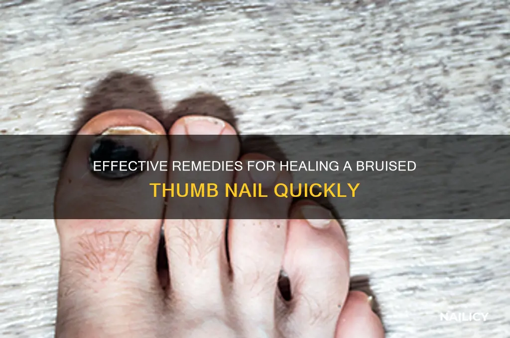 Effective Remedies For Healing A Bruised Thumb Nail Quickly | Nailicy