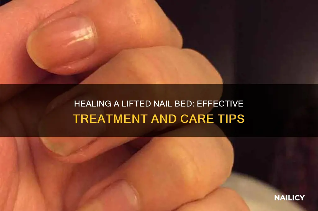 Healing A Lifted Nail Bed: Effective Treatment And Care Tips | Nailicy