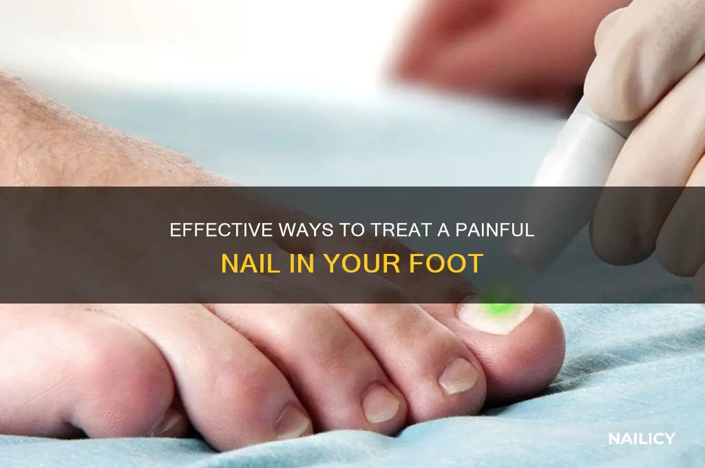 Effective Ways To Treat A Painful Nail In Your Foot | Nailicy