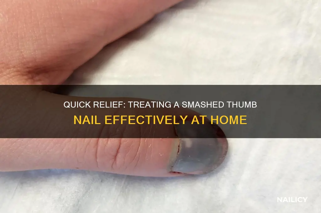 Quick Relief: Treating A Smashed Thumb Nail Effectively At Home | Nailicy