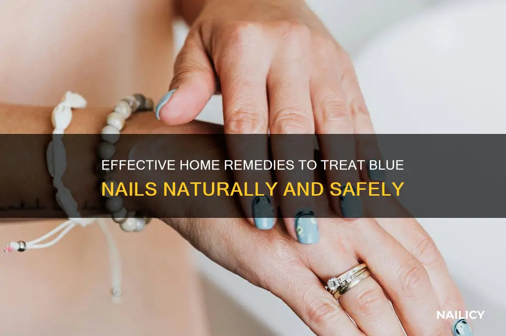 Effective Home Remedies To Treat Blue Nails Naturally And Safely | Nailicy