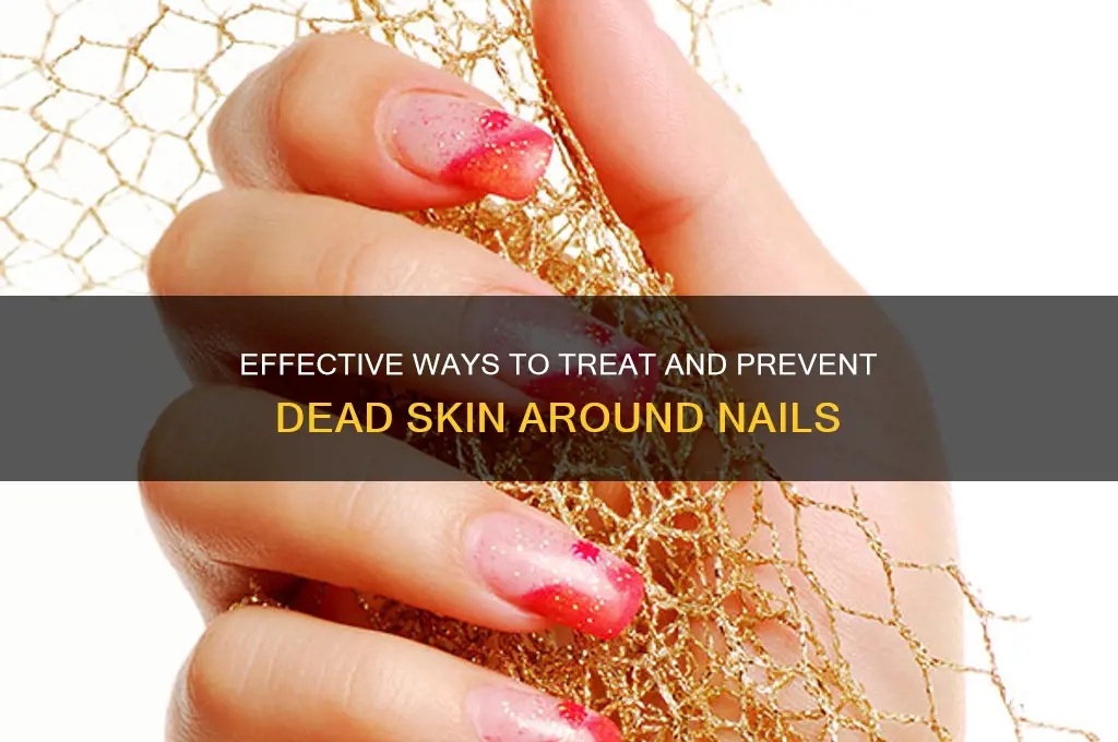 Effective Ways To Treat And Prevent Dead Skin Around Nails | Nailicy