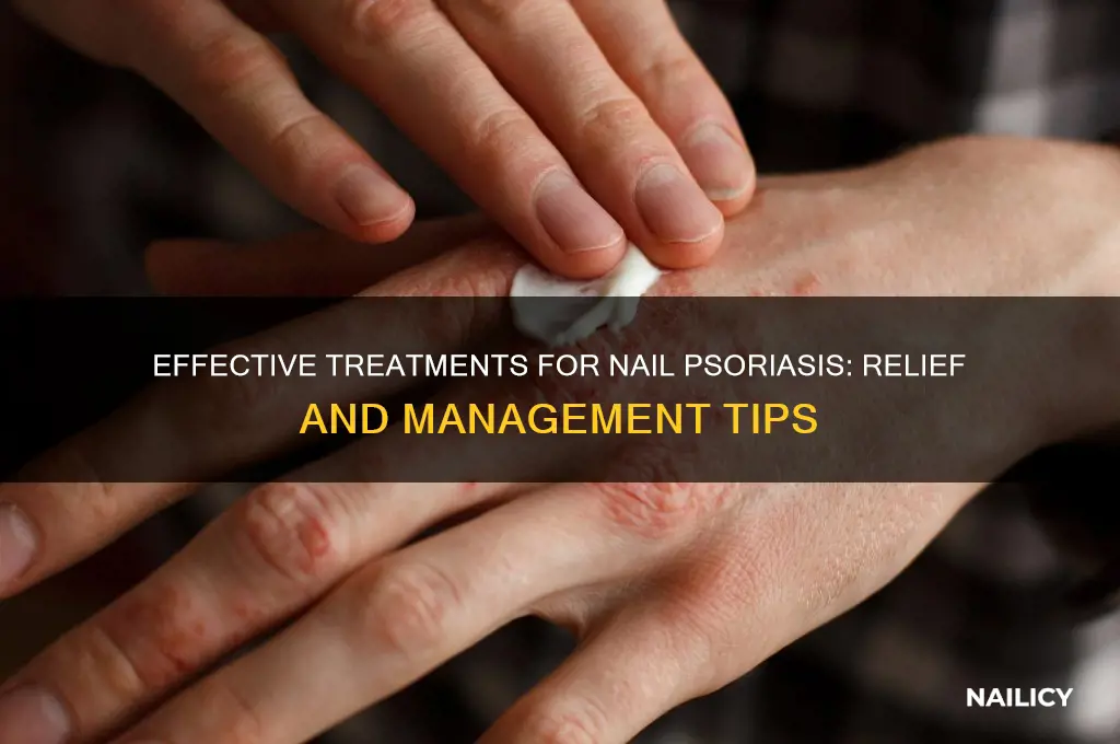 Effective Treatments For Nail Psoriasis: Relief And Management Tips ...