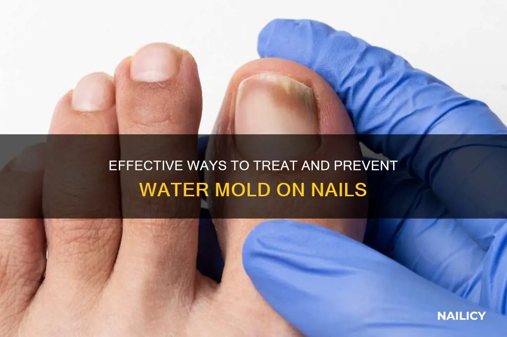 Effective Ways To Treat And Prevent Water Mold On Nails | Nailicy
