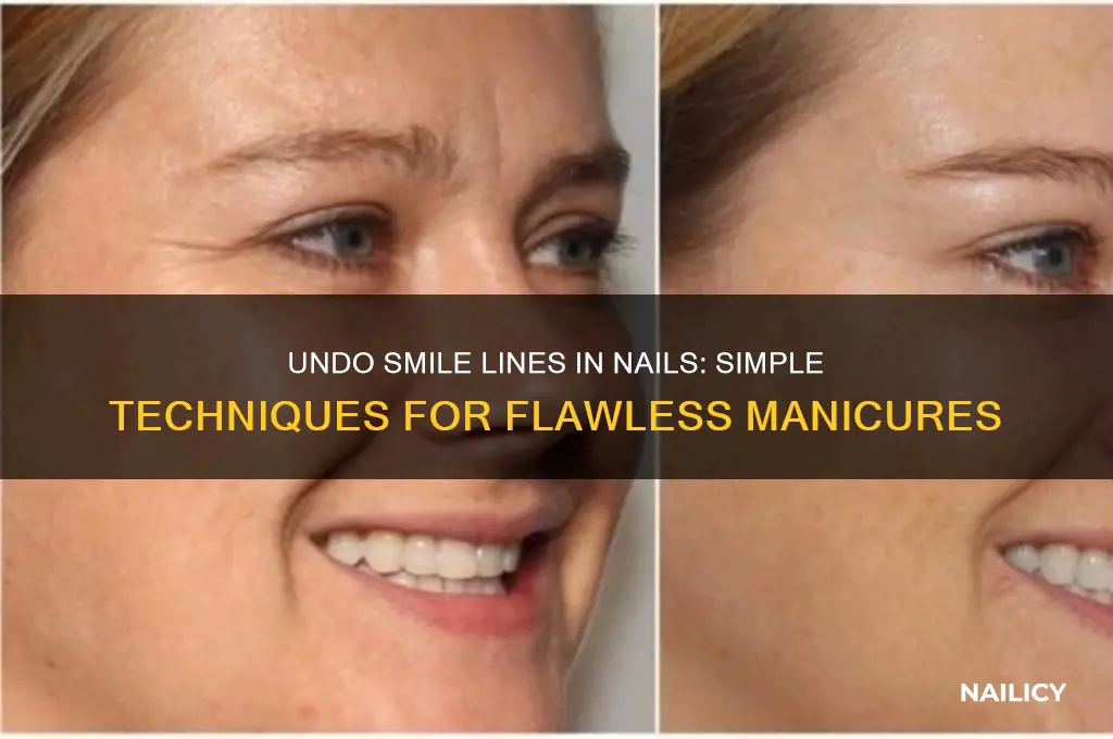Undo Smile Lines In Nails: Simple Techniques For Flawless Manicures ...