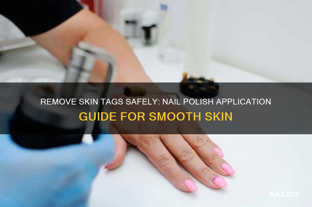 Remove Skin Tags Safely: Nail Polish Application Guide For Smooth Skin ...