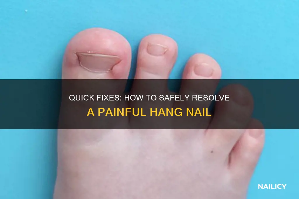 Quick Fixes: How To Safely Resolve A Painful Hang Nail | Nailicy
