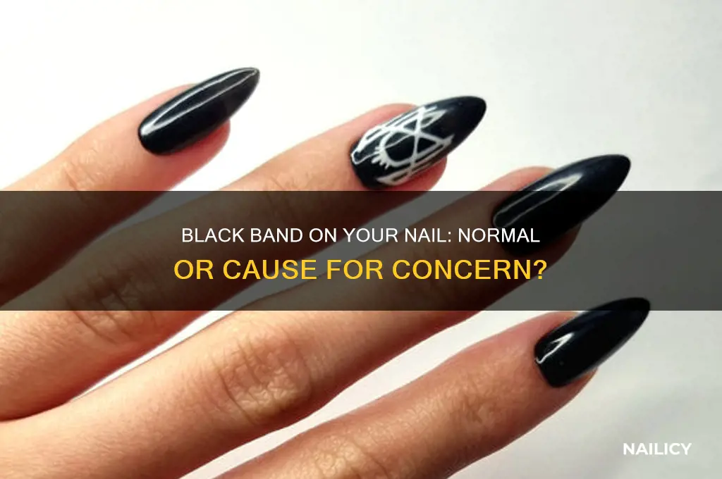 Black Band On Your Nail: Normal Or Cause For Concern? | Nailicy