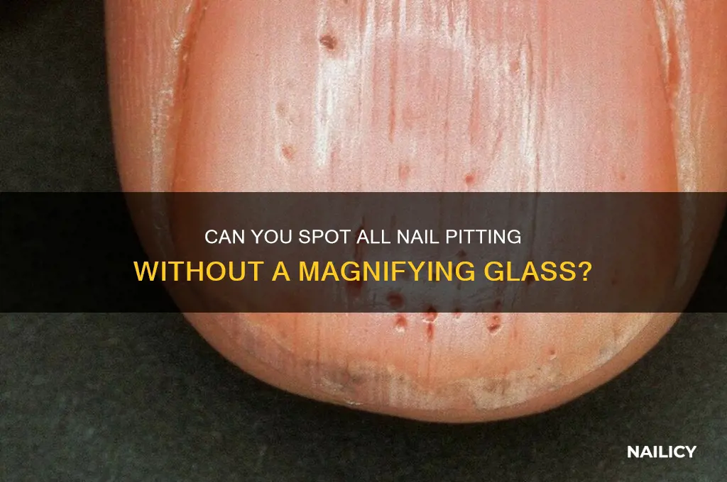 Can You Spot All Nail Pitting Without A Magnifying Glass? | Nailicy