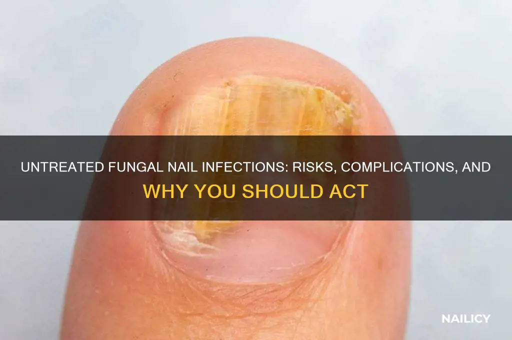 Untreated Fungal Nail Infections: Risks, Complications, And Why You ...