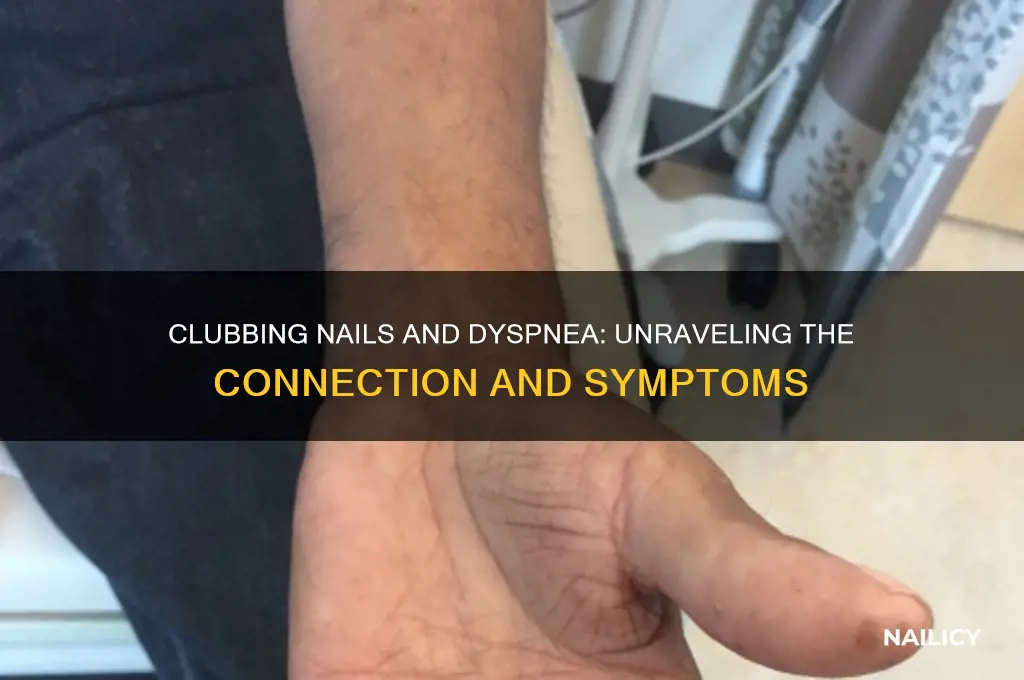 Clubbing Nails And Dyspnea: Unraveling The Connection And Symptoms ...