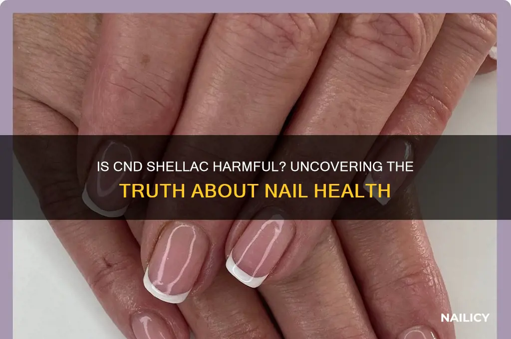 Is Cnd Shellac Harmful? Uncovering The Truth About Nail Health | Nailicy