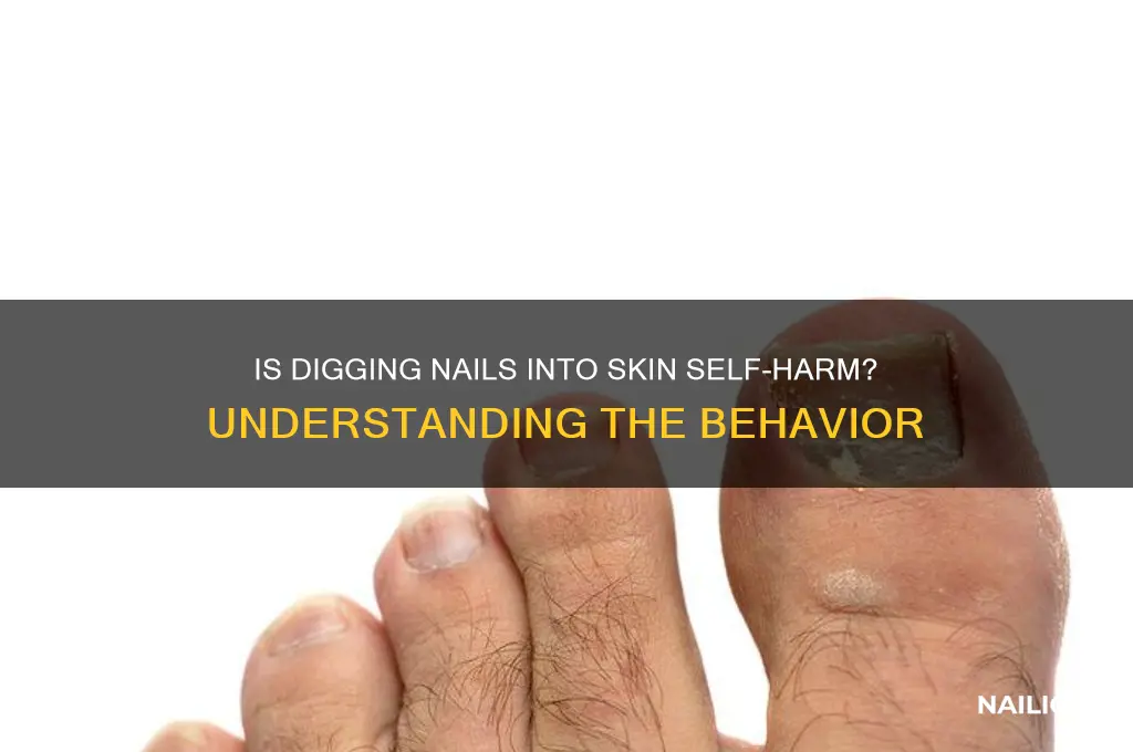 Is Digging Nails Into Skin Self-Harm? Understanding The Behavior | Nailicy