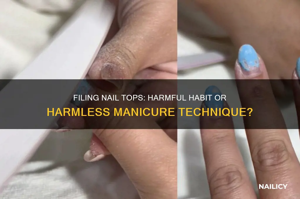 Filing Nail Tops: Harmful Habit Or Harmless Manicure Technique? | Nailicy