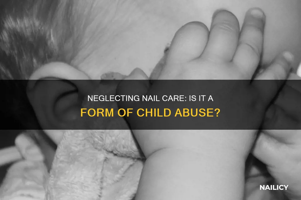 Neglecting Nail Care: Is It A Form Of Child Abuse? | Nailicy