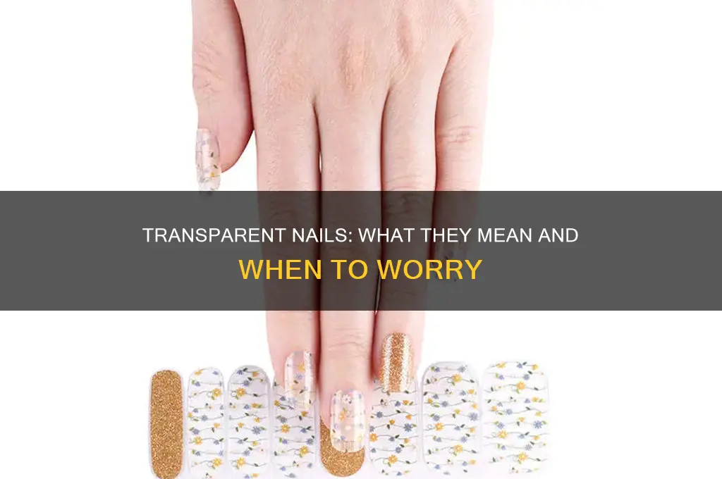 Transparent Nails: What They Mean And When To Worry | Nailicy