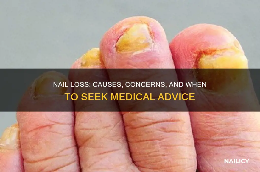 Nail Loss: Causes, Concerns, And When To Seek Medical Advice | Nailicy