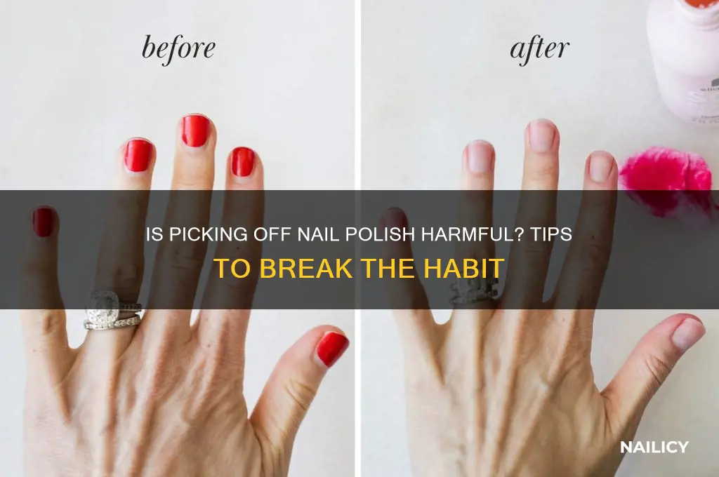 Is Picking Off Nail Polish Harmful? Tips To Break The Habit | Nailicy