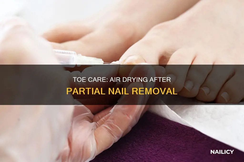 Toe Care: Air Drying After Partial Nail Removal | Nailicy