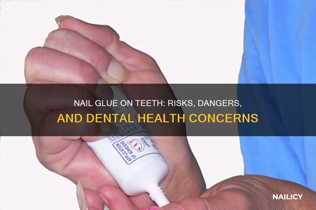 Nail Glue On Teeth: Risks, Dangers, And Dental Health Concerns | Nailicy