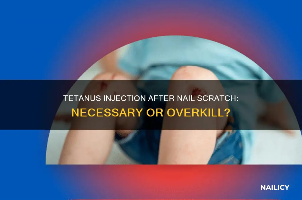 Tetanus Injection After Nail Scratch: Necessary Or Overkill? | Nailicy