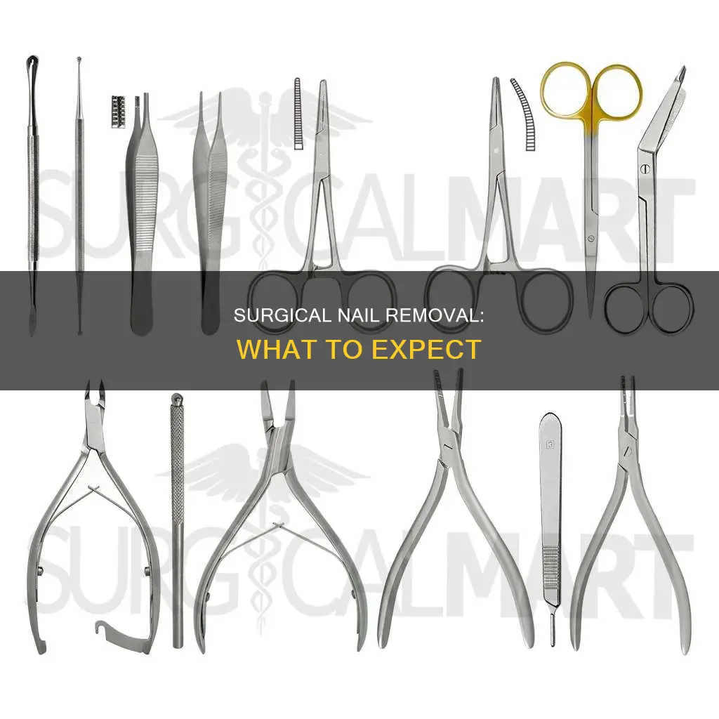 Surgical Nail Removal: What To Expect | Nailicy