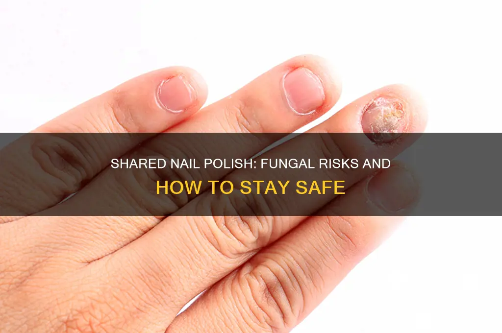 Shared Nail Polish: Fungal Risks And How To Stay Safe | Nailicy