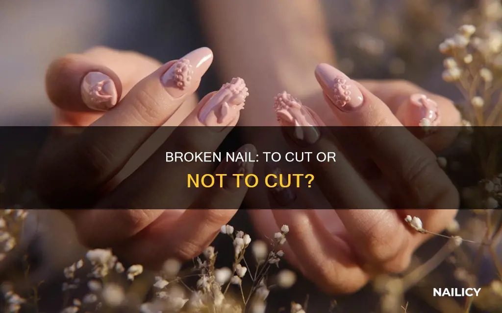 Broken Nail: To Cut Or Not To Cut? | Nailicy