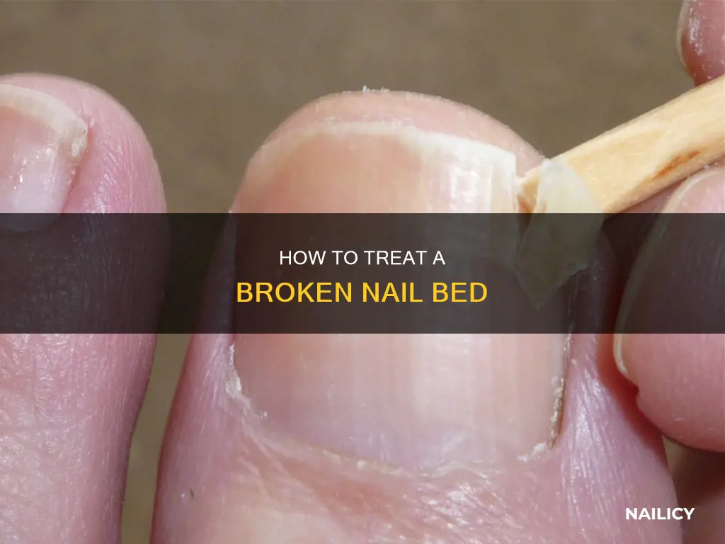 How To Treat A Broken Nail Bed | Nailicy