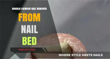 Tibial Nail Removal: When And Why? | Nailicy