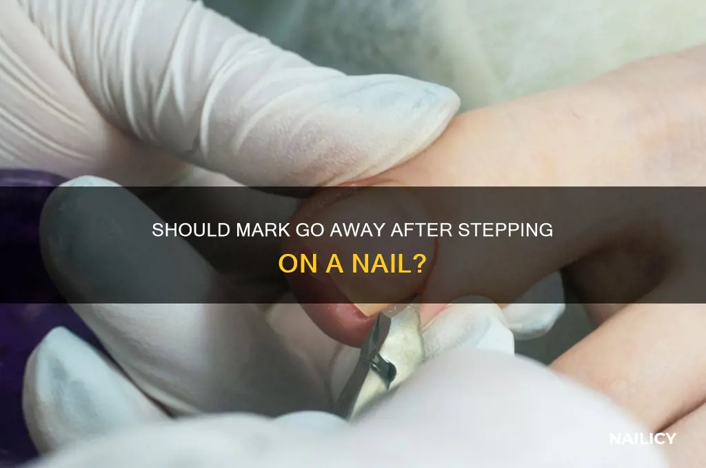 Should Mark Go Away After Stepping On A Nail? | Nailicy