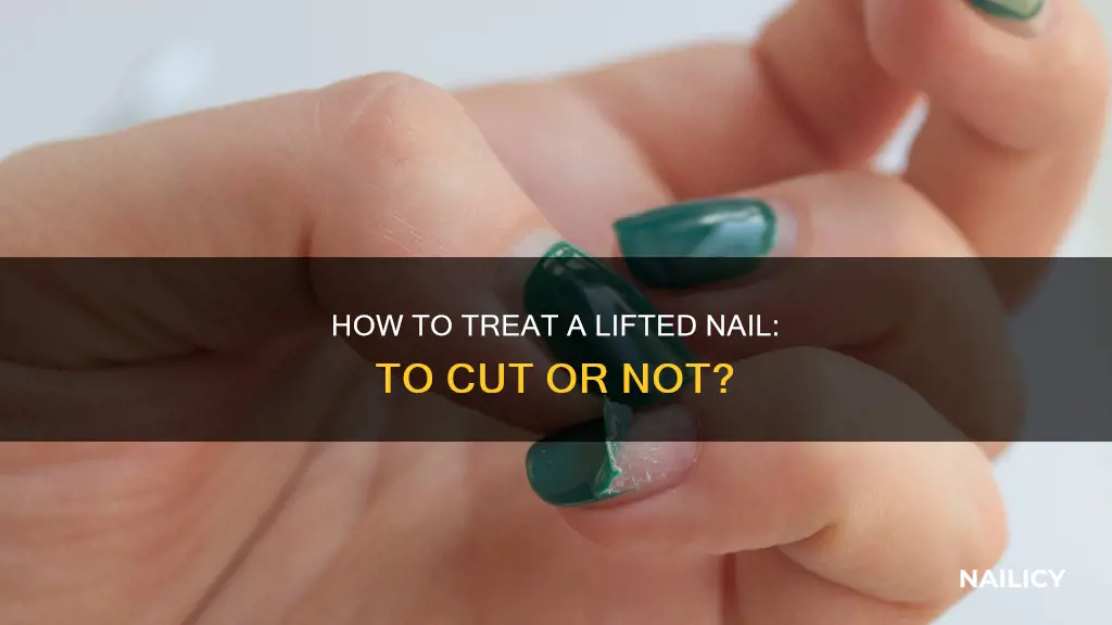 How To Treat A Lifted Nail: To Cut Or Not? | Nailicy