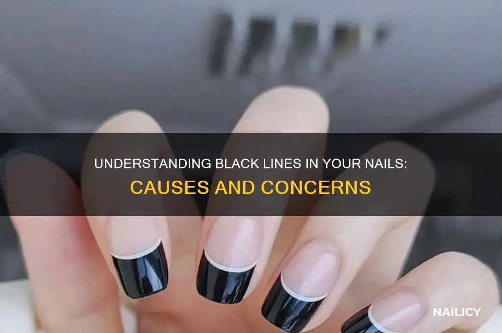 Understanding Black Lines In Your Nails: Causes And Concerns | Nailicy