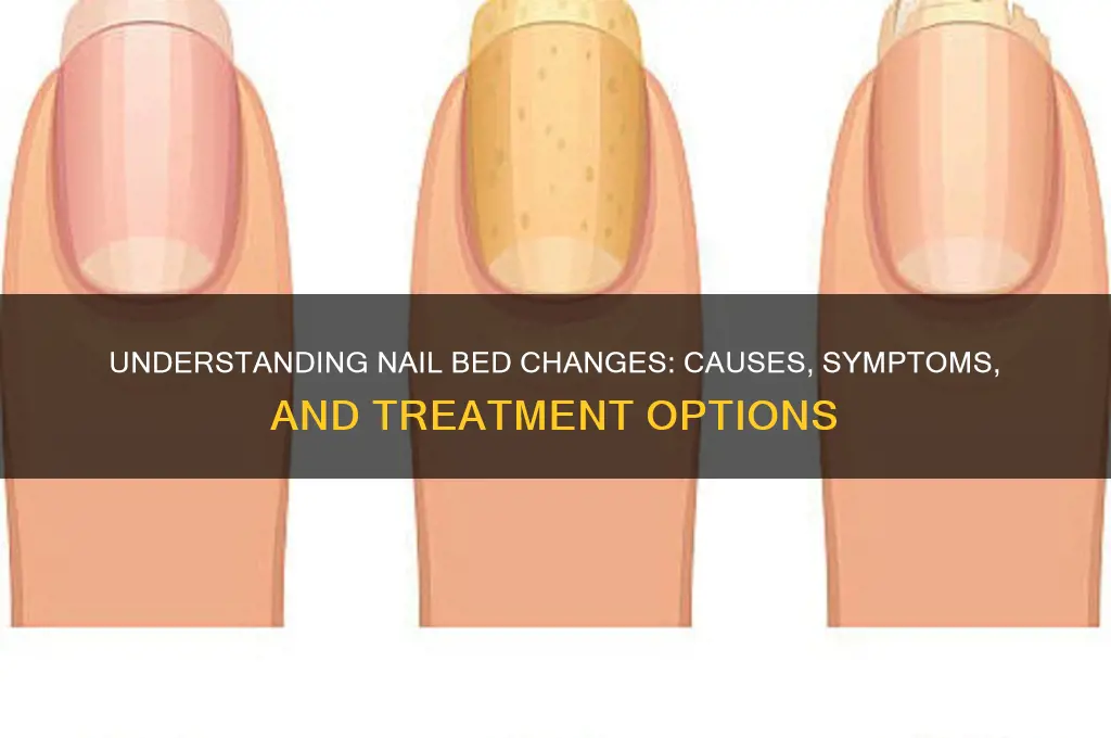 Understanding Nail Bed Changes: Causes, Symptoms, And Treatment Options ...