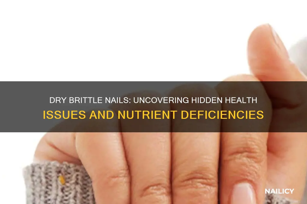 Dry Brittle Nails: Uncovering Hidden Health Issues And Nutrient ...