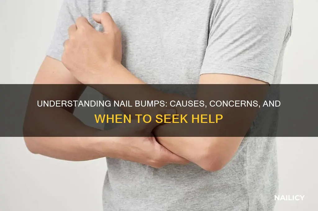 Understanding Nail Bumps: Causes, Concerns, And When To Seek Help | Nailicy