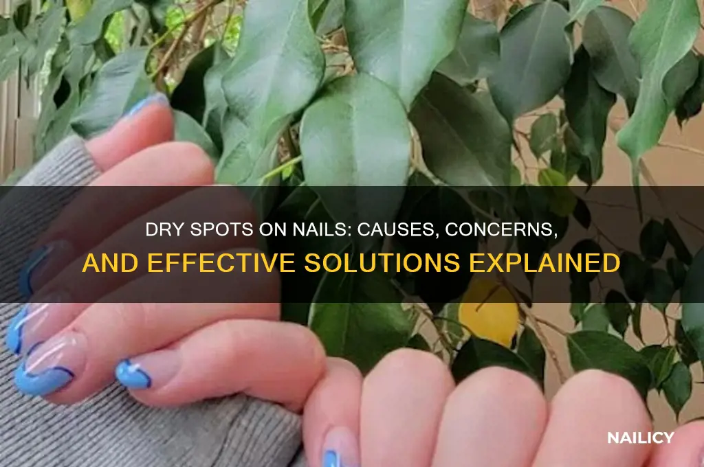 Dry Spots On Nails: Causes, Concerns, And Effective Solutions Explained ...