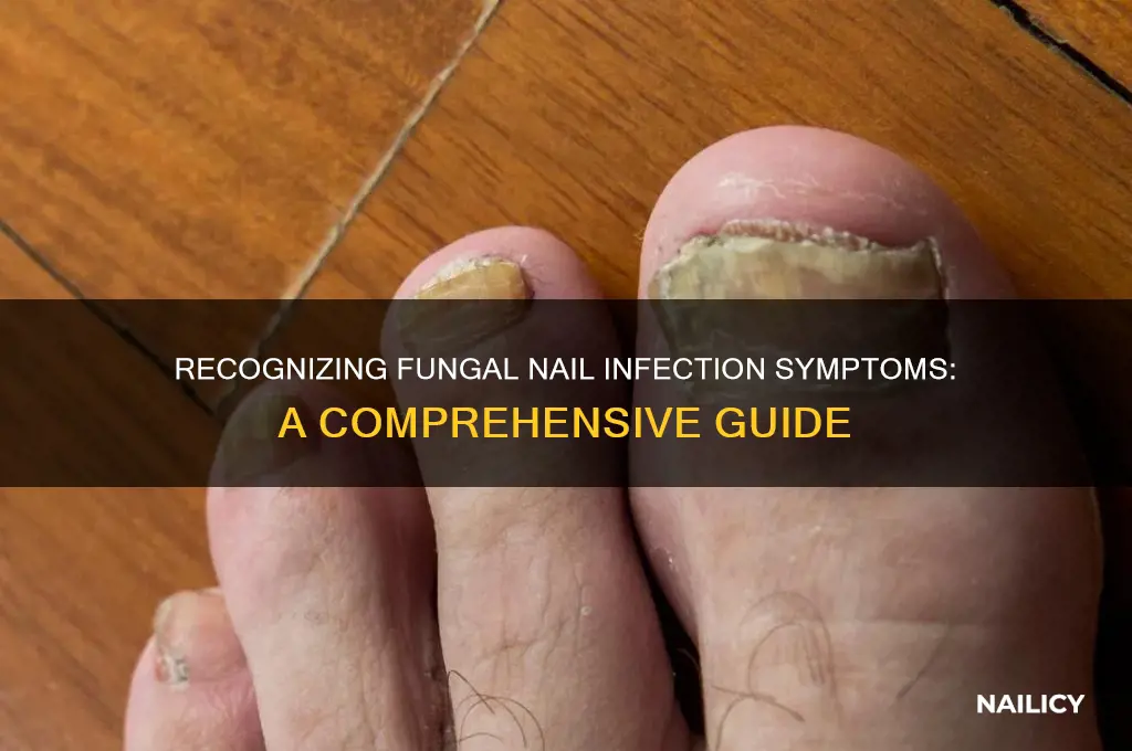 Recognizing Fungal Nail Infection Symptoms: A Comprehensive Guide | Nailicy