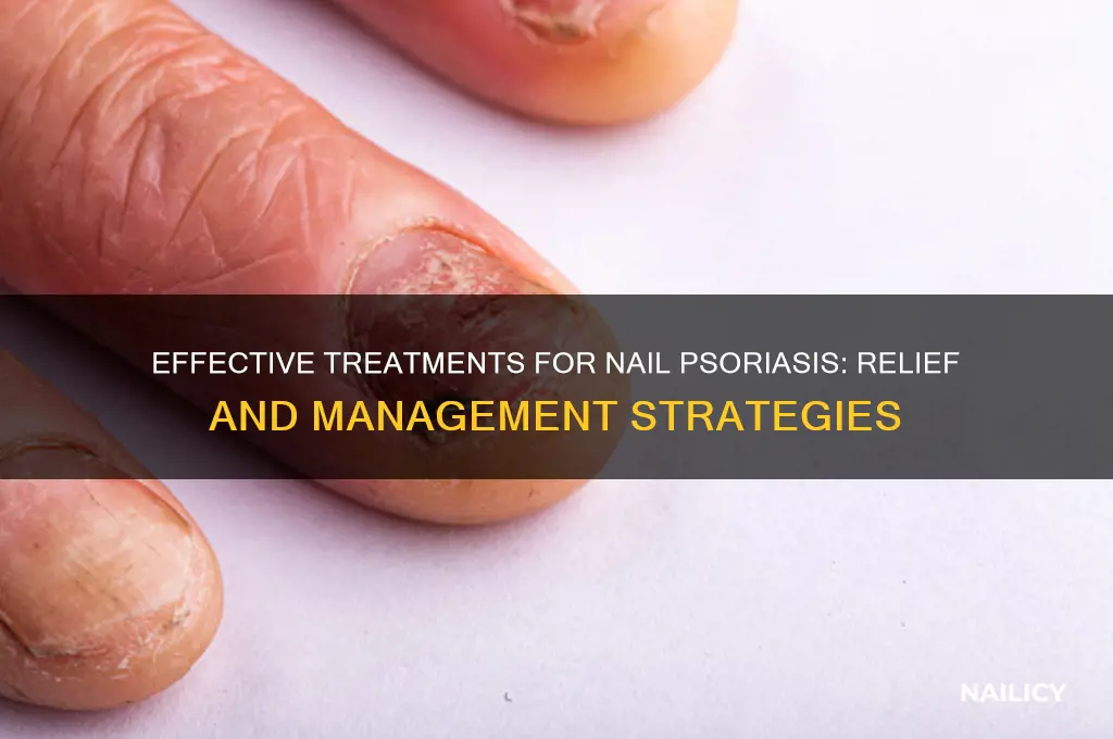 Effective Treatments For Nail Psoriasis: Relief And Management ...