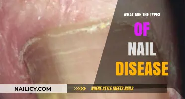 Understanding Vertical Nail Lines: Causes, Concerns, And When To Seek ...