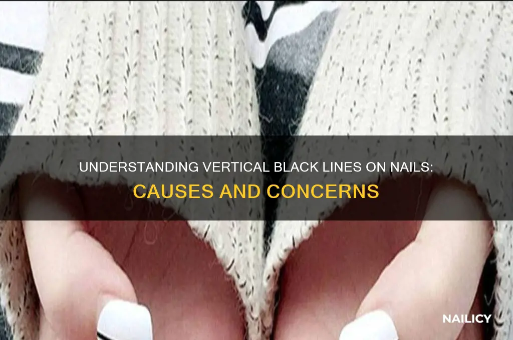 Understanding Vertical Black Lines On Nails: Causes And Concerns | Nailicy