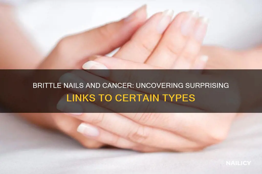 Brittle Nails And Cancer: Uncovering Surprising Links To Certain Types ...