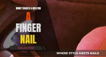 The Mystery Of Double Finger Nails: Causes And Cures | Nailicy