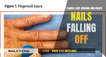 The Mystery Of Double Finger Nails: Causes And Cures | Nailicy