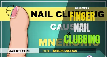 The Mystery Of Double Finger Nails: Causes And Cures | Nailicy