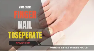 Purple Fingernails: What Are The Underlying Causes? | Nailicy