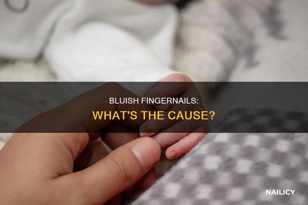 Bluish Fingernails: What's The Cause? | Nailicy
